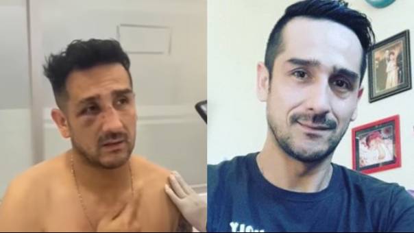 Awal Mula Claudio Martinez Diduga Dikeroyok Waiter Kelab Malam ...