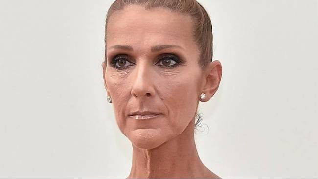 Gejala dan Penyebab Stiff Person Syndrome yang Dialami Celine Dion ...