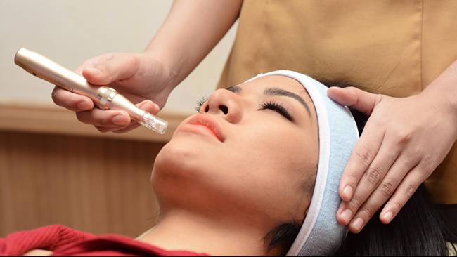 Solusi Mengatasi Jerawat dengan Treatment Dermapen Eva Mulia Clinic